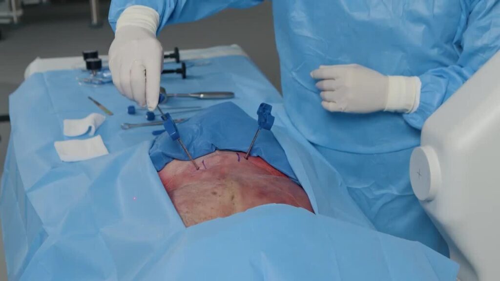 Kyphoplasty : Best Option Restore Spinal Compression Fractures